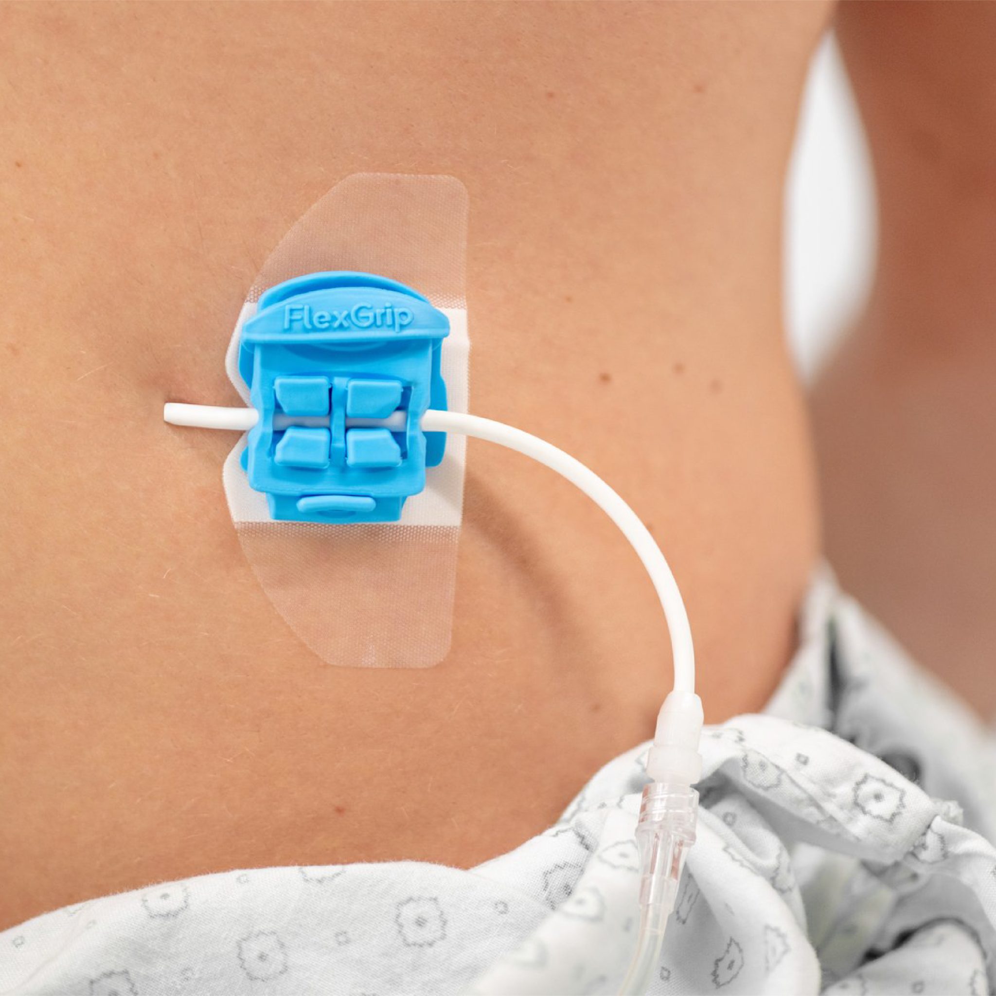 FlexGRIP Universal – Ateria Medika